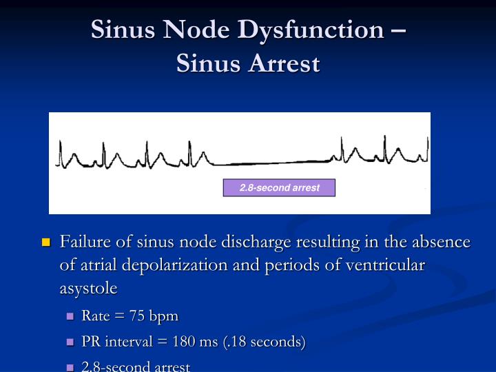 PPT - Pacemaker General Concepts PowerPoint Presentation - ID:3197620
