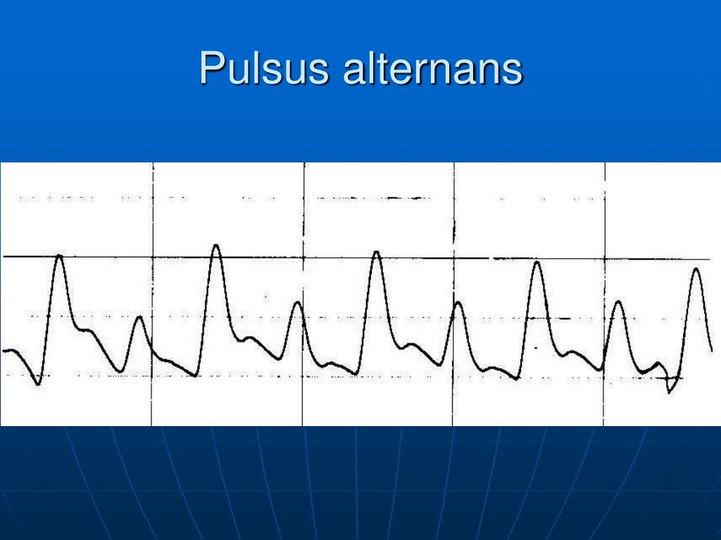 PPT - Invasive blood pressure monitoring in critical care PowerPoint ...