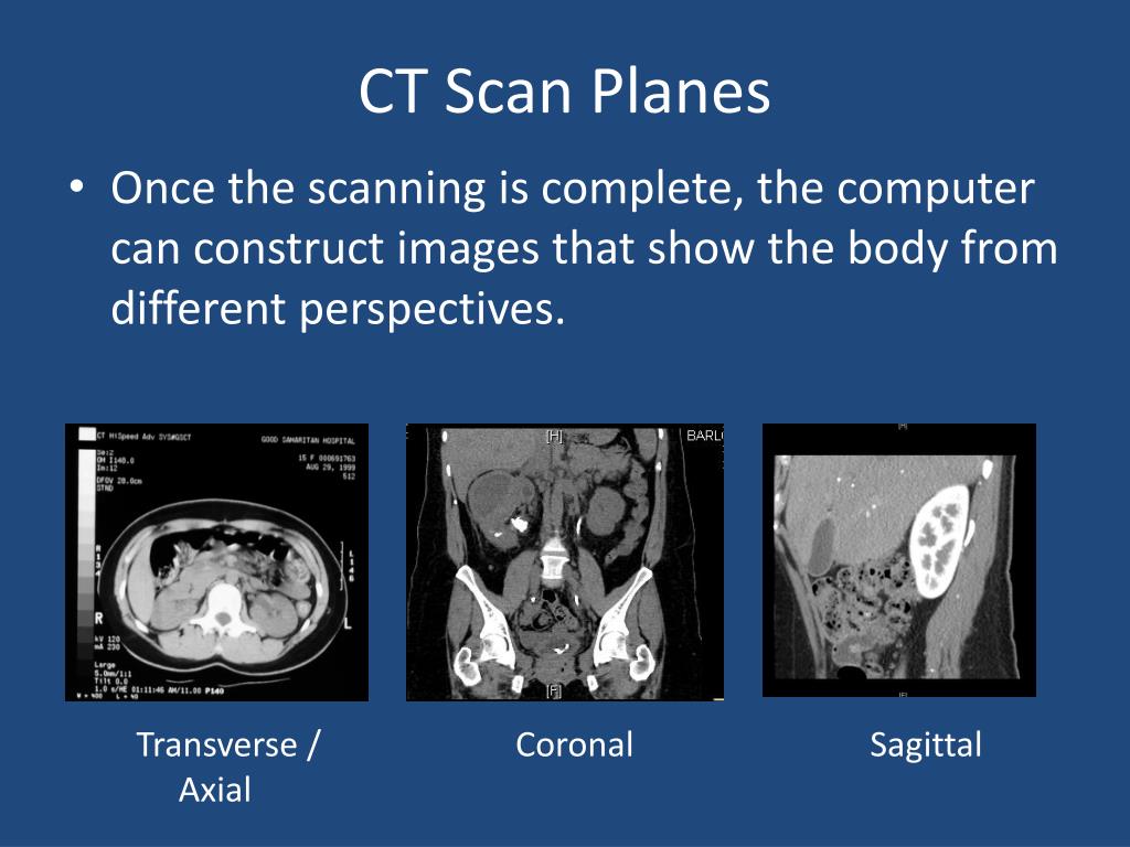 PPT - Uroradiology For Medical Students PowerPoint Presentation, free ...