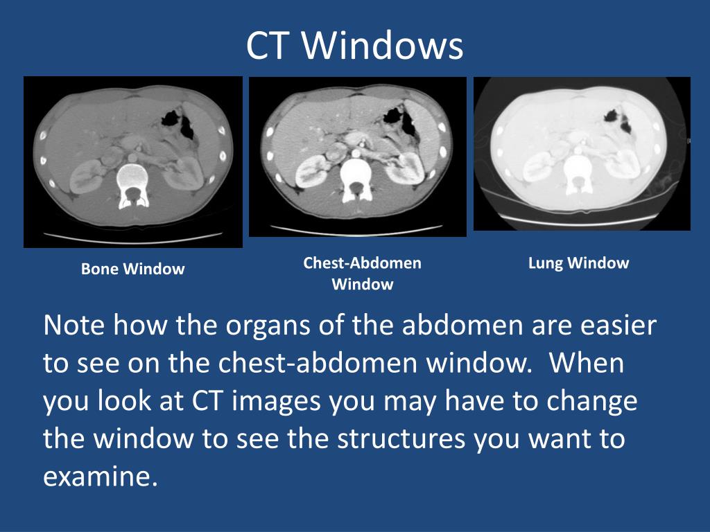 PPT - Uroradiology For Medical Students PowerPoint Presentation, free ...