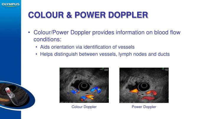 PPT - OLYMPUS EUS PowerPoint Presentation - ID:3201218