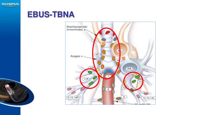 PPT - OLYMPUS EUS PowerPoint Presentation - ID:3201218