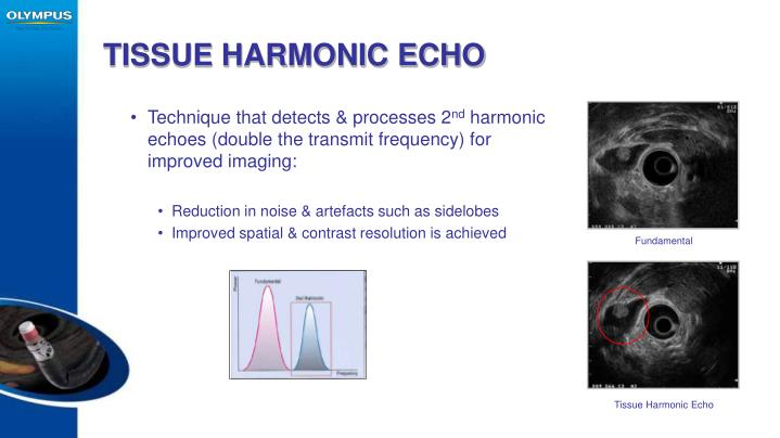 PPT - OLYMPUS EUS PowerPoint Presentation - ID:3201218