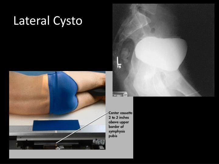 PPT - Lab Positioning for GU SYSTEM IVP & Cysto & ERCP PowerPoint ...