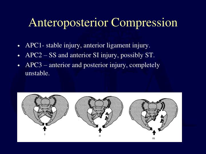 PPT - Anatomy, Radiographic Evaluation, and Classification of Pelvic ...