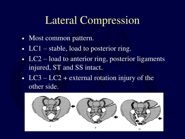 PPT - Anatomy, Radiographic Evaluation, and Classification of Pelvic ...