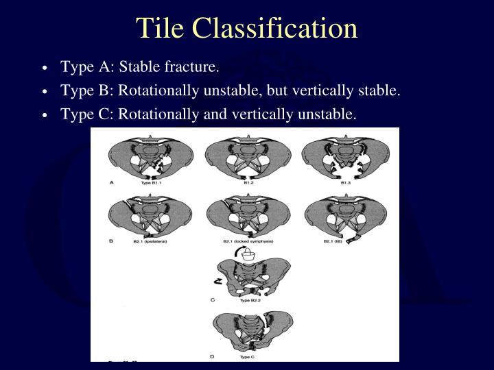 PPT - Anatomy, Radiographic Evaluation, and Classification of Pelvic ...
