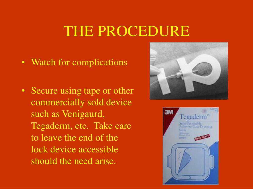 PPT - SALINE LOCK Presented By The Wayne County Medical Control Board ...