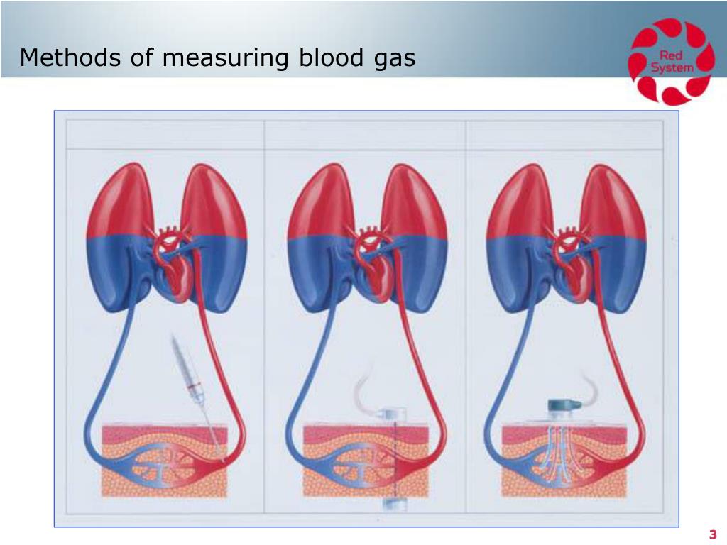 PPT - Radiometer Medical ApS, Åkandevej 21, DK-2700 Brønshøj, Tel: +45 ...