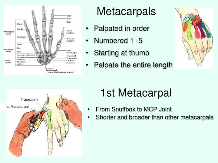 PPT - Metacarpals PowerPoint Presentation, free download - ID:3203797