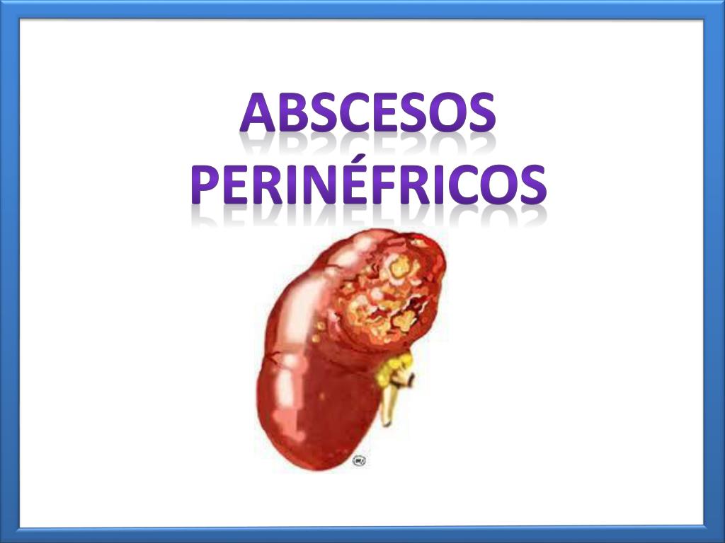 PPT - INFECCIONES DEL TRACTO URINARIO PowerPoint Presentation, free ...