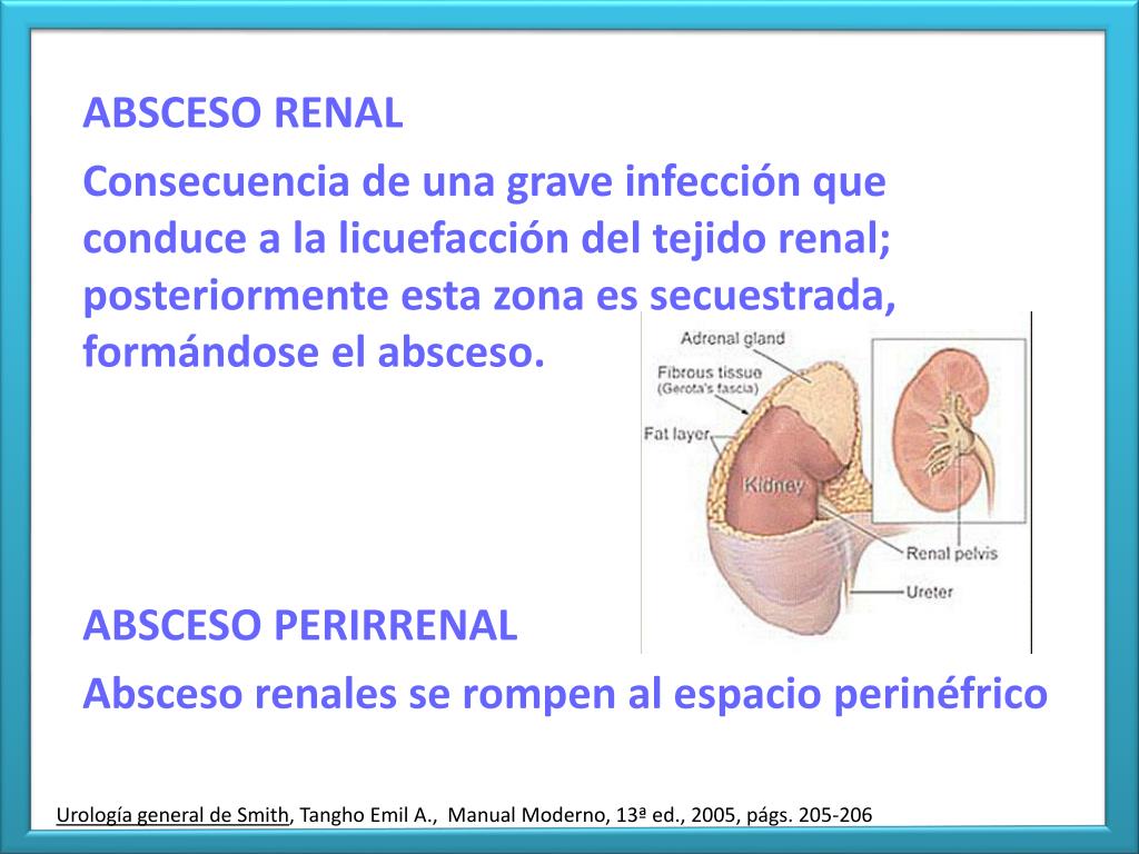 PPT - INFECCIONES DEL TRACTO URINARIO PowerPoint Presentation, free ...