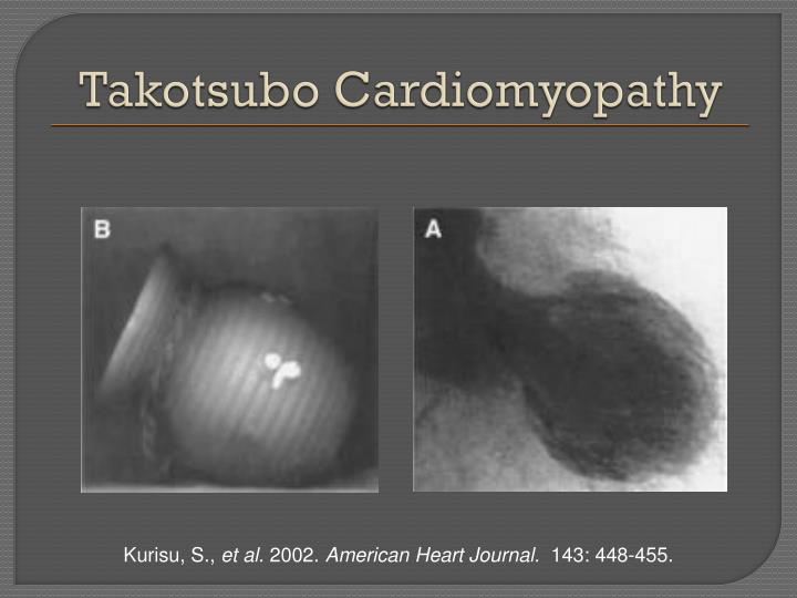 PPT - Takotsubo Cardiomyopathy PowerPoint Presentation - ID:3207213
