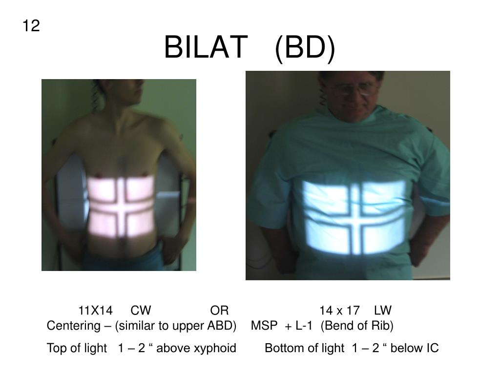 PPT - PA -anterior side BEST SEEN AP -posterior side BEST SEEN ...