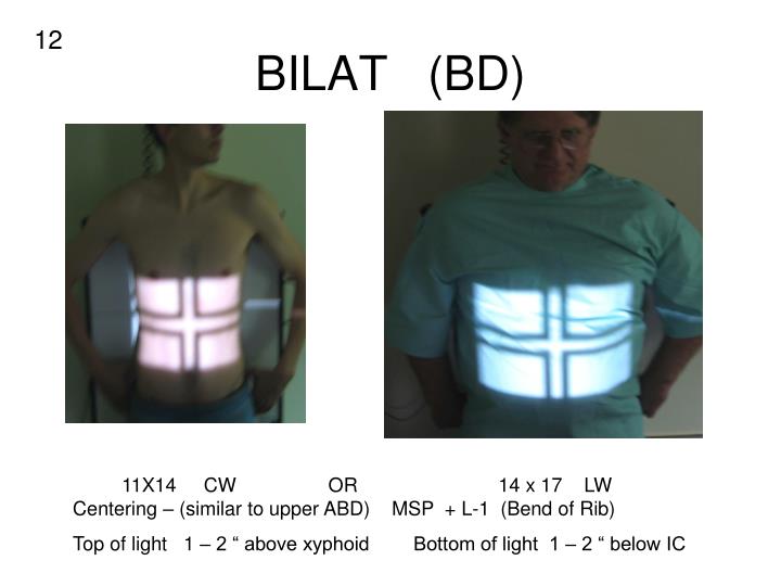 PPT - PA -anterior side BEST SEEN AP -posterior side BEST SEEN ...
