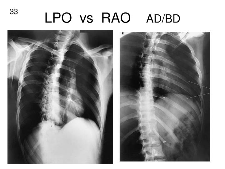 PPT - PA -anterior side BEST SEEN AP -posterior side BEST SEEN ...