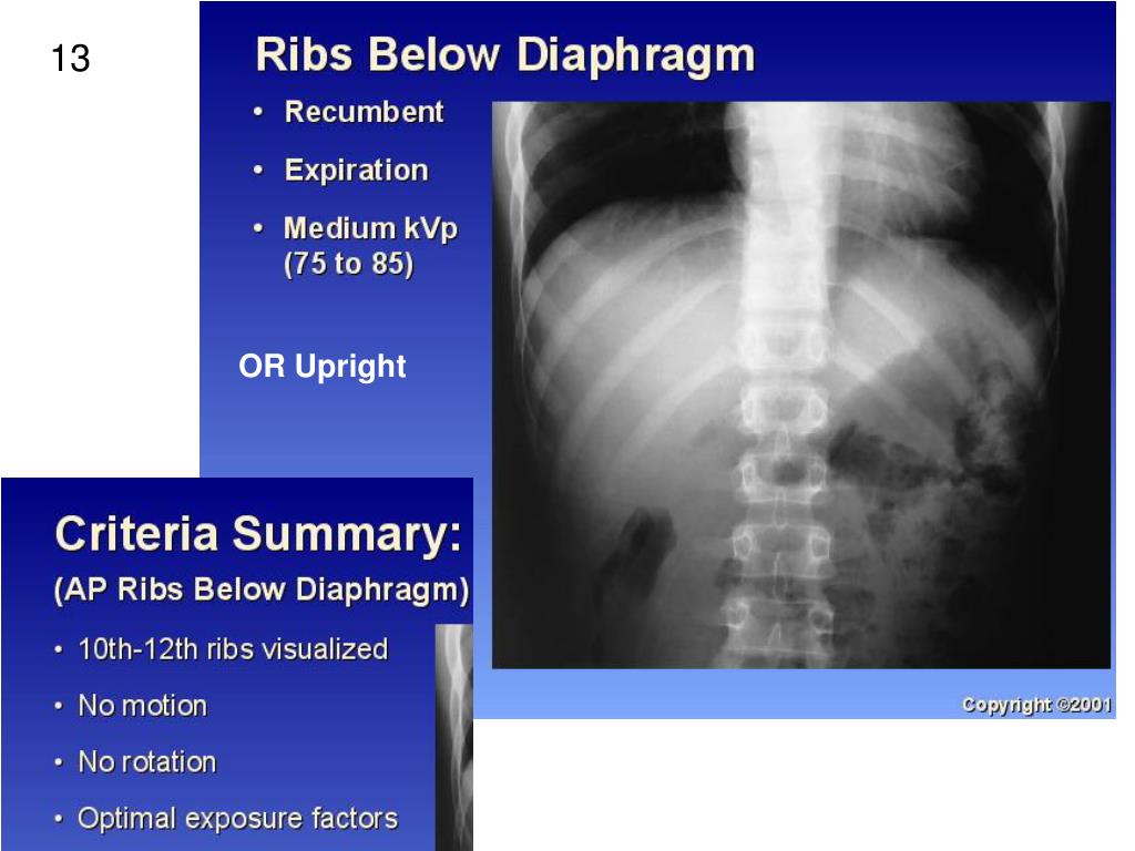 PPT - PA -anterior side BEST SEEN AP -posterior side BEST SEEN ...