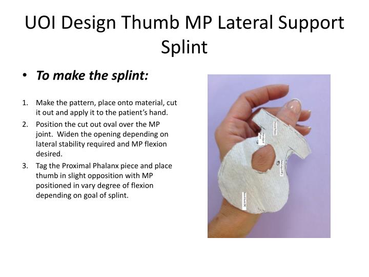 PPT - Innovative Splinting options for the Thumb MP joint PowerPoint ...