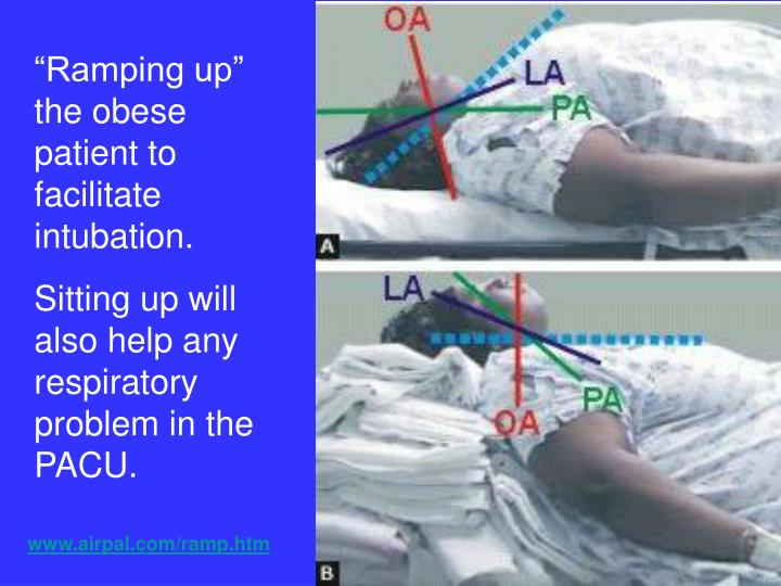 PPT - Respiratory problems in the OB PACU PowerPoint Presentation - ID ...