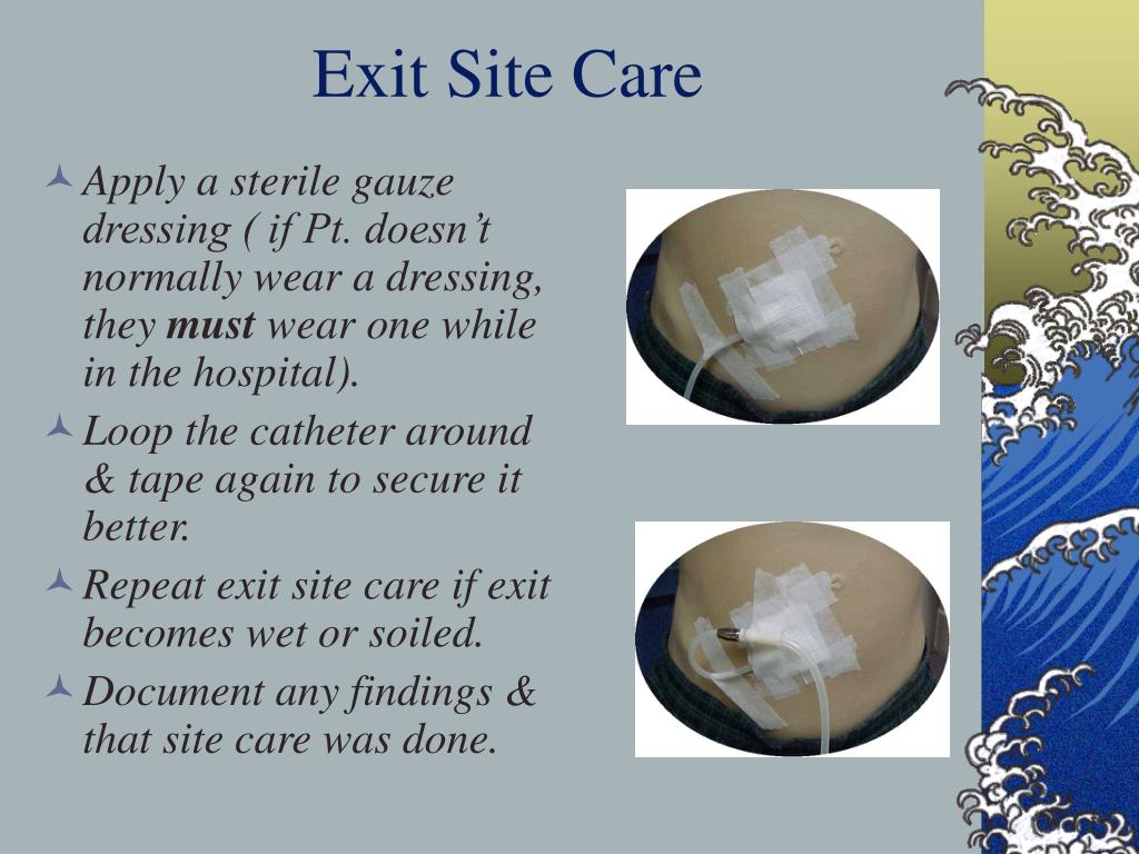 PPT - CARE OF THE HOSPITALIZED PERITONEAL DIALYSIS PATIENT PowerPoint ...