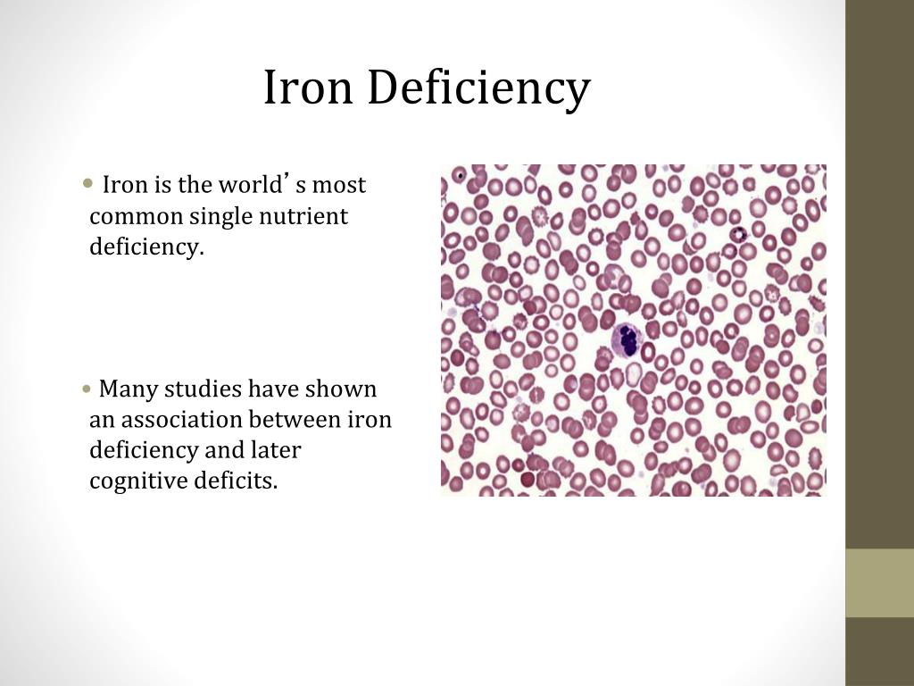 PPT - Rangel QI Ironing out the kinks: Improving Screening and ...