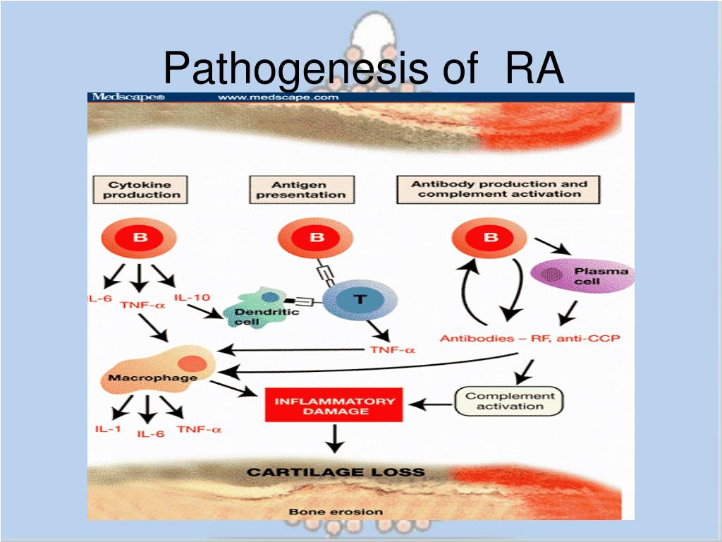 PPT - New Treatments for Rheumatoid Arthritis PowerPoint Presentation ...