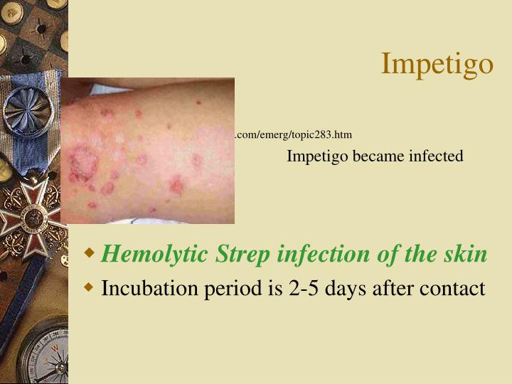 PPT - Pediatric Skin Disorders PowerPoint Presentation - ID:3211704