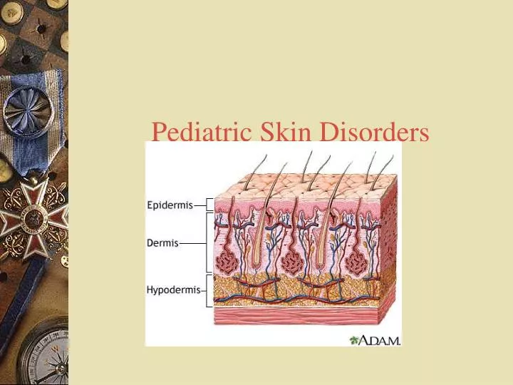 PPT - Pediatric Skin Disorders PowerPoint Presentation, free download ...
