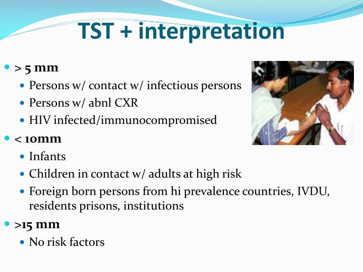 PPT - Pediatric Tuberculosis PowerPoint Presentation - ID:3211903