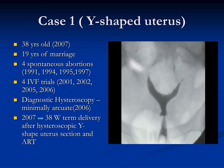 Ppt Hysteroscopic Section Of T Y Shaped Uterus Powerpoint