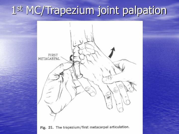 PPT - Clinical Examination of the Hand and Wrist PowerPoint ...