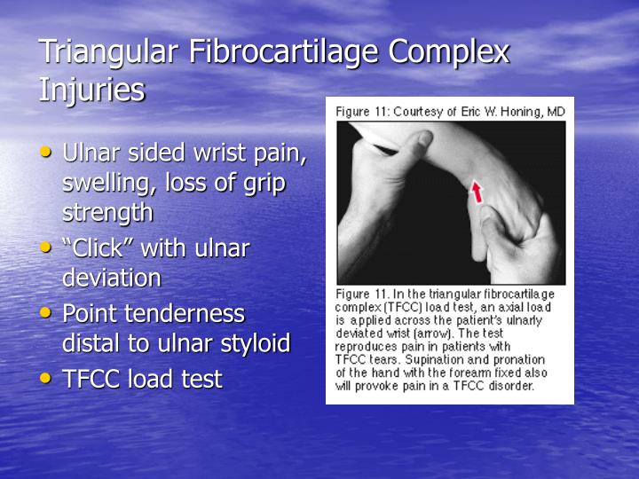 PPT - Clinical Examination of the Hand and Wrist PowerPoint ...