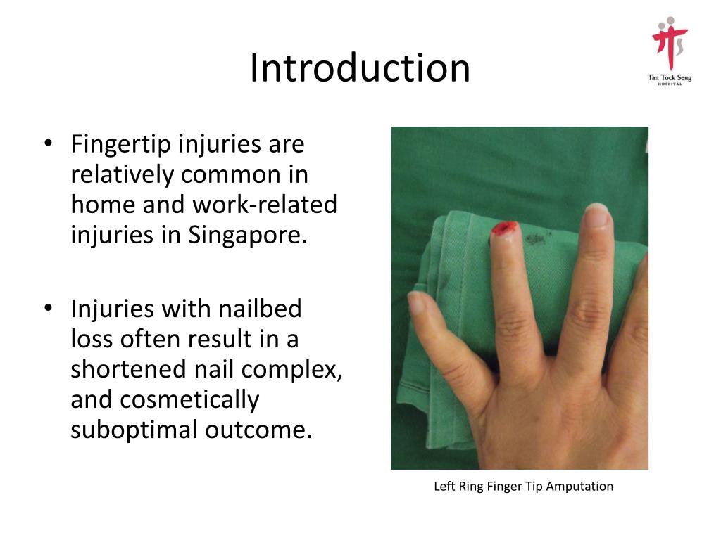 PPT - Modified VY-plasty for Traumatic Distal Nailbed Loss PowerPoint ...