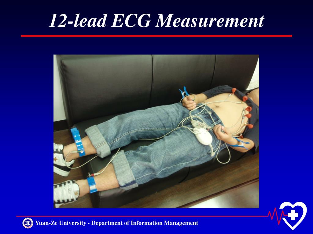 PPT - The Telecardiology of 12-Lead ECG PowerPoint Presentation, free ...