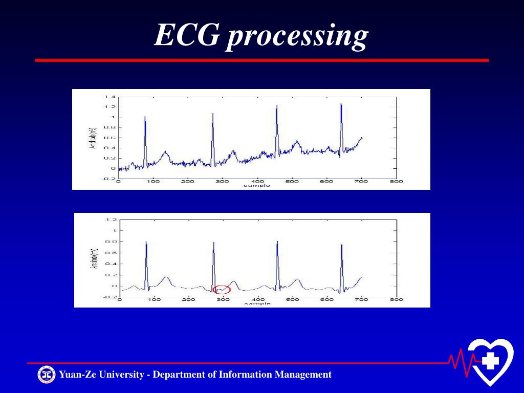 PPT - The Telecardiology of 12-Lead ECG PowerPoint Presentation, free ...