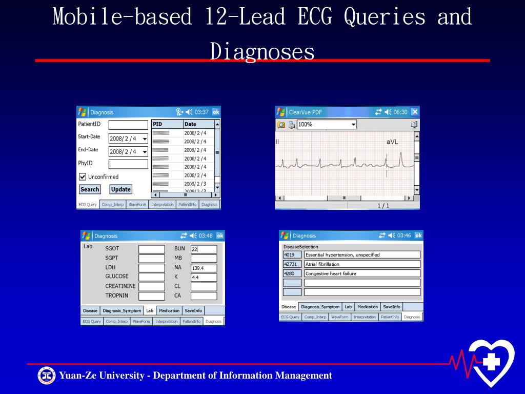 PPT - The Telecardiology of 12-Lead ECG PowerPoint Presentation, free ...