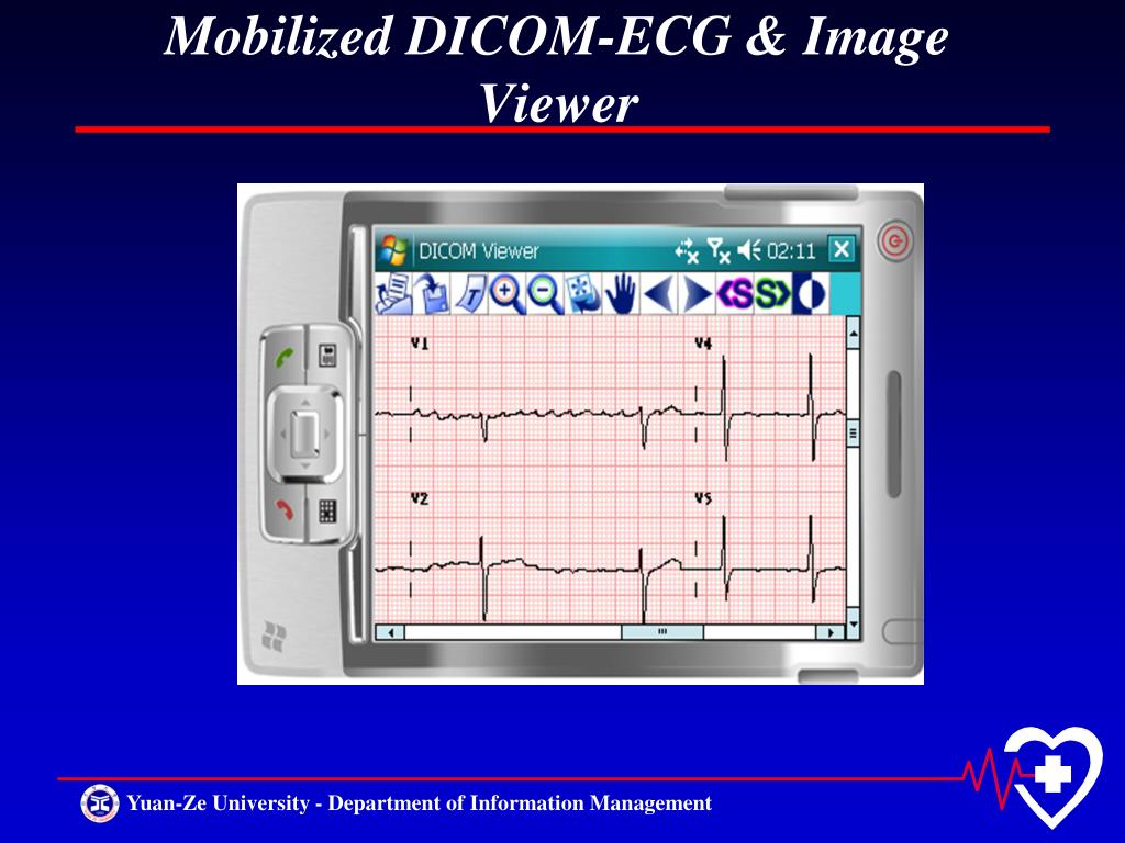 PPT - The Telecardiology of 12-Lead ECG PowerPoint Presentation, free download - ID:3216719