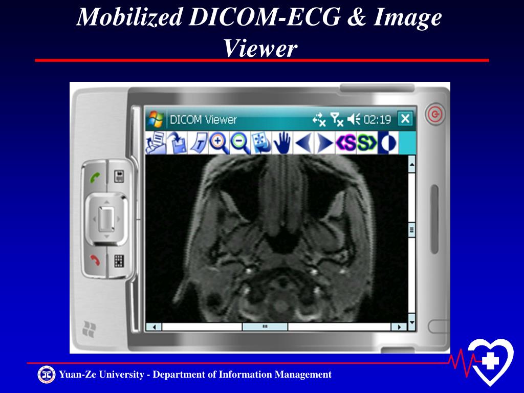 PPT - The Telecardiology of 12-Lead ECG PowerPoint Presentation, free ...