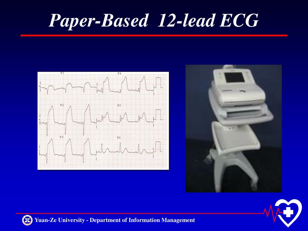 PPT - The Telecardiology of 12-Lead ECG PowerPoint Presentation, free ...