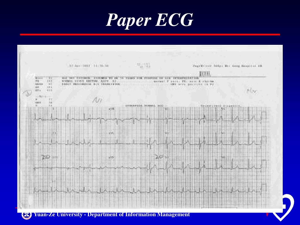 PPT - The Telecardiology of 12-Lead ECG PowerPoint Presentation, free ...
