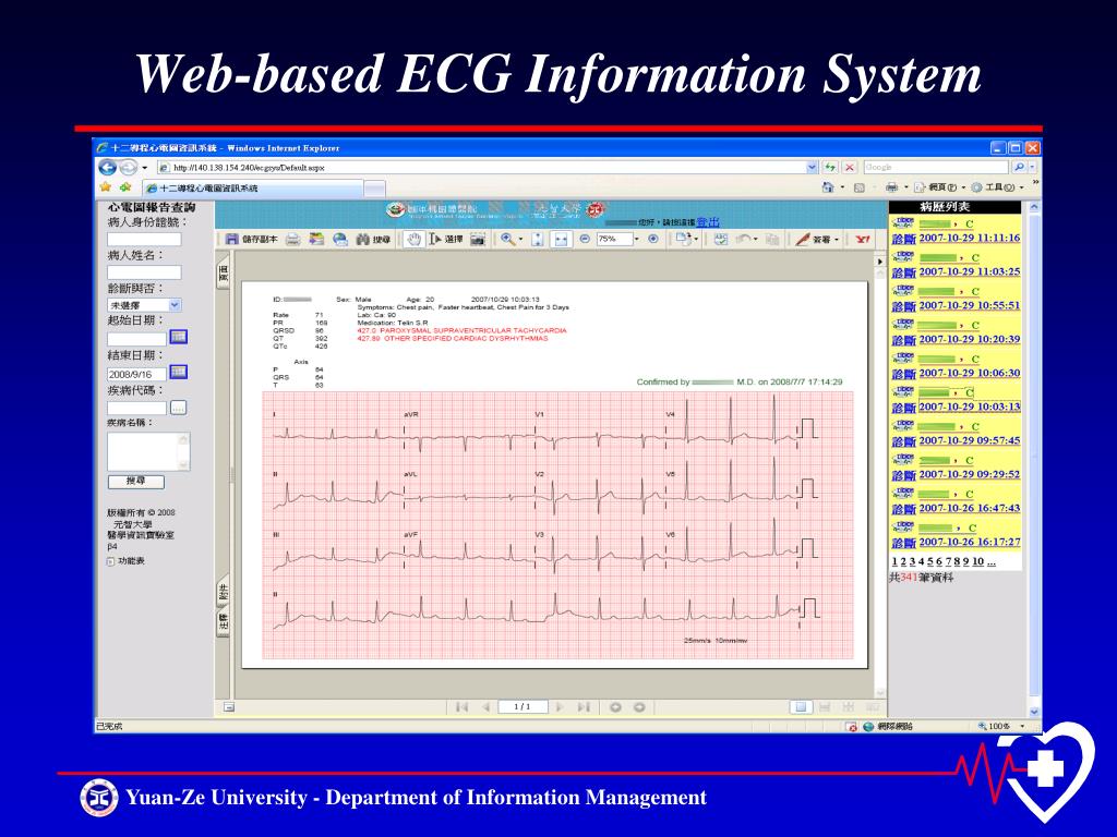 PPT - The Telecardiology of 12-Lead ECG PowerPoint Presentation, free ...