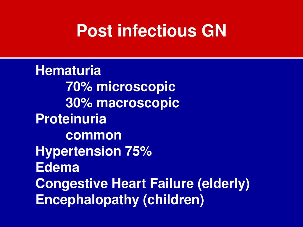 PPT - 2006 Renal Week Lecture 3 Hematuria and Glomerulonephritis Debbie ...