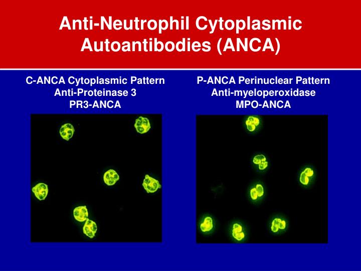 PPT - Case PowerPoint Presentation - ID:3217057