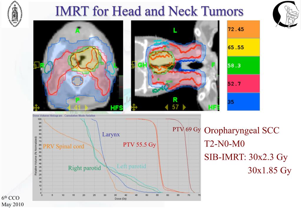 PPT - Radiation dose painting in Head and Neck treatment: how far are ...