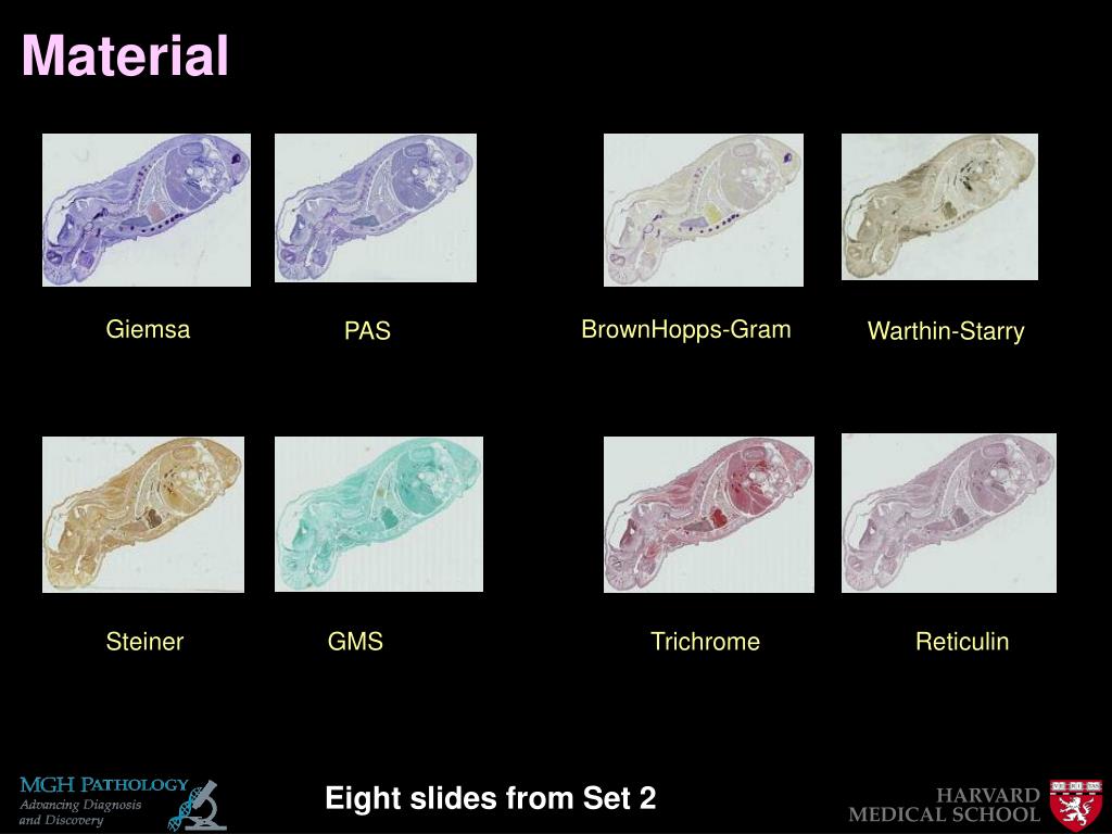 PPT - Anurag Sharma 1 , Mark Merren 2 , Pinky Bautista 2 , Roy Lee 2 ...