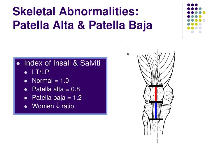 PPT - The Knee Complex PowerPoint Presentation - ID:3218763