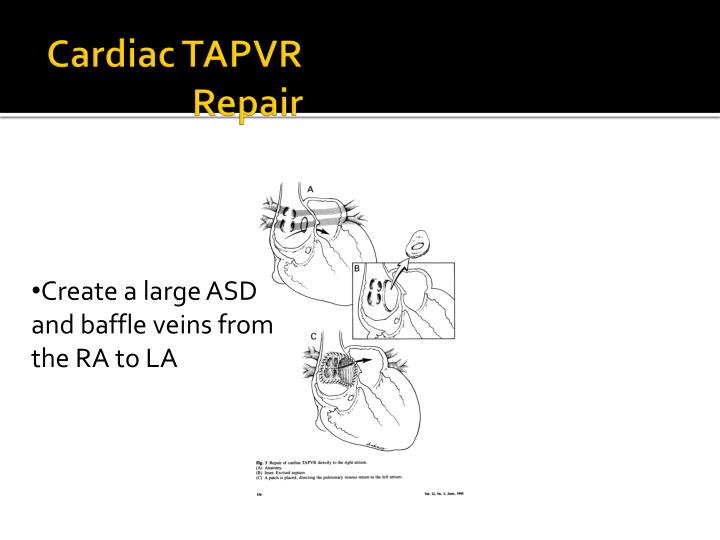 PPT - Cardiac Surgical Anomalies in the Neonate PowerPoint Presentation ...