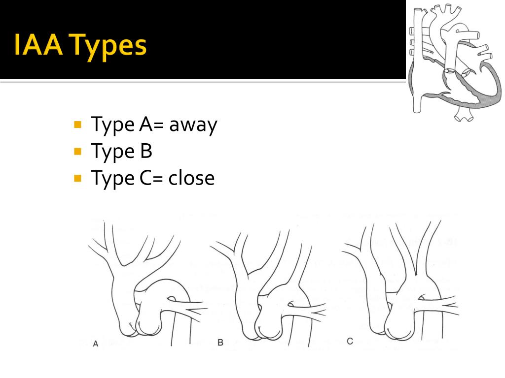PPT - Cardiac Surgical Anomalies in the Neonate PowerPoint Presentation ...