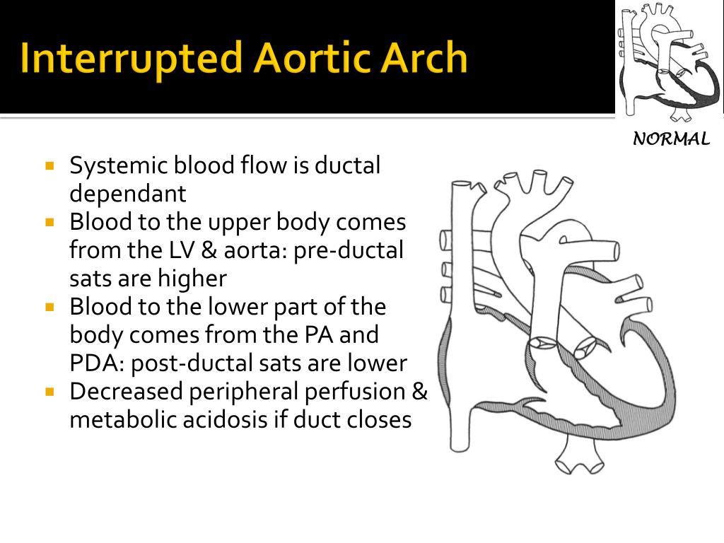 PPT - Cardiac Surgical Anomalies in the Neonate PowerPoint Presentation ...