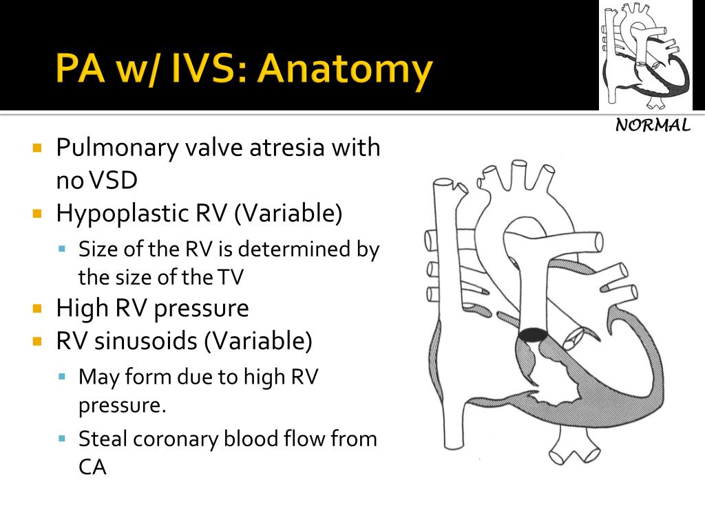 PPT - Cardiac Surgical Anomalies in the Neonate PowerPoint Presentation ...